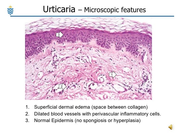 Pathology of Skin - Common Disorders