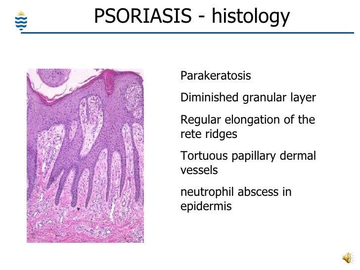 Pathology Of Skin Common Disorders