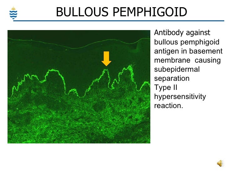 Pathology of Skin - Common Disorders