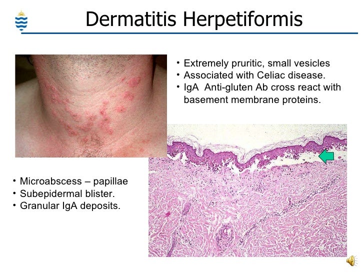 Pathology of Skin - Common Disorders