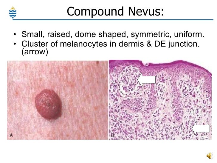 Pathology of Skin - Common Disorders
