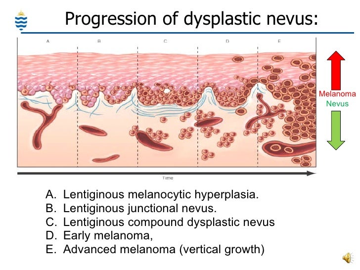 Pathology of Skin - Common Disorders