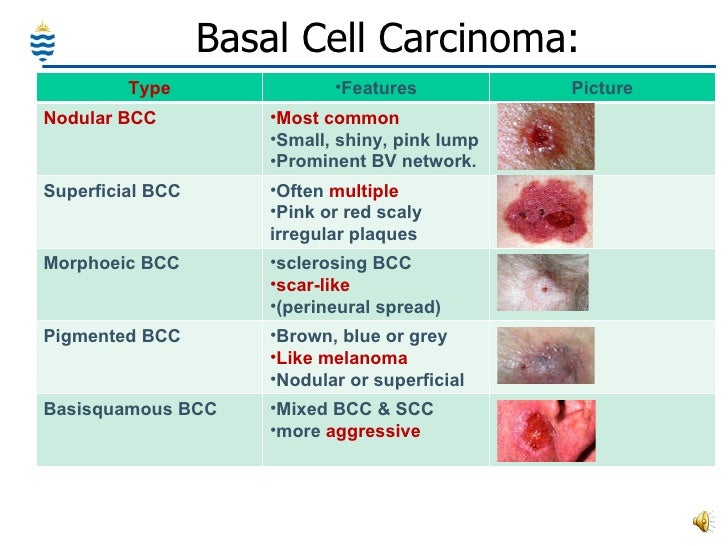 Pathology of Skin - Common Disorders