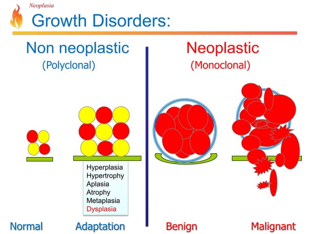 Pathology Lecture - Neoplasia | PPTX | Cancer | Diseases and Conditions