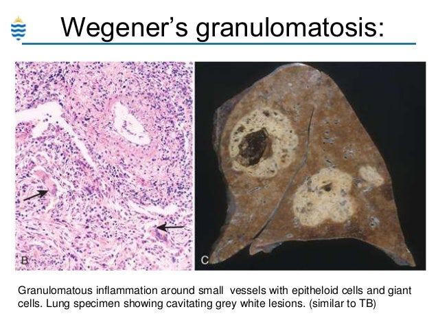 Pathology Review-Term1