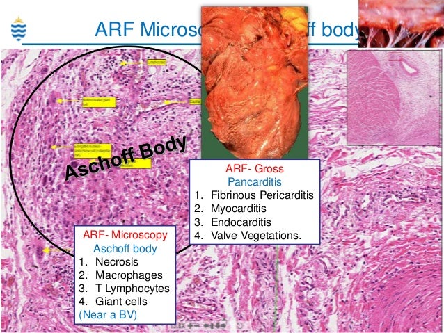 Pathology Review-Term1