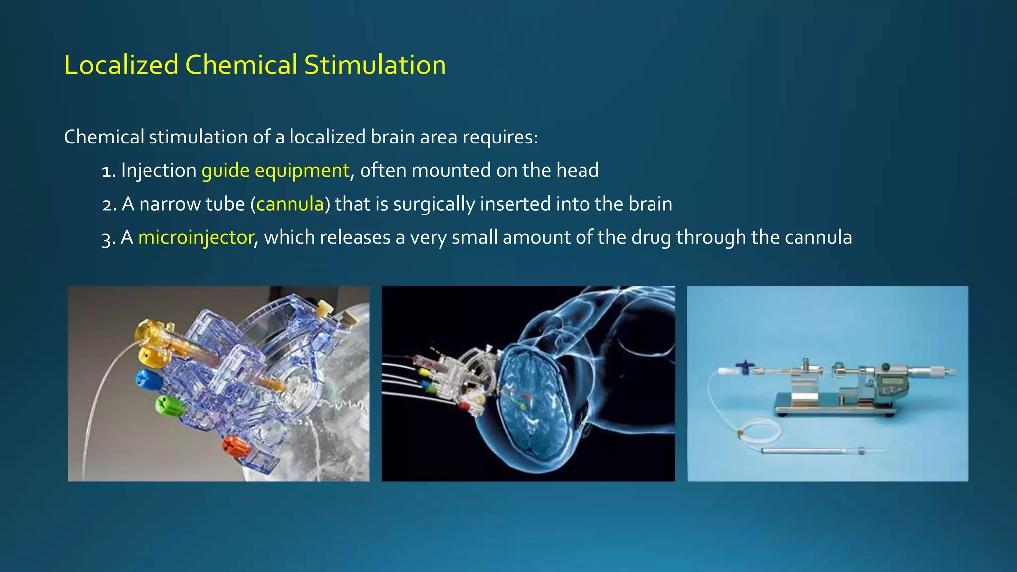 MBB 10 Brain Stimulation.pptx