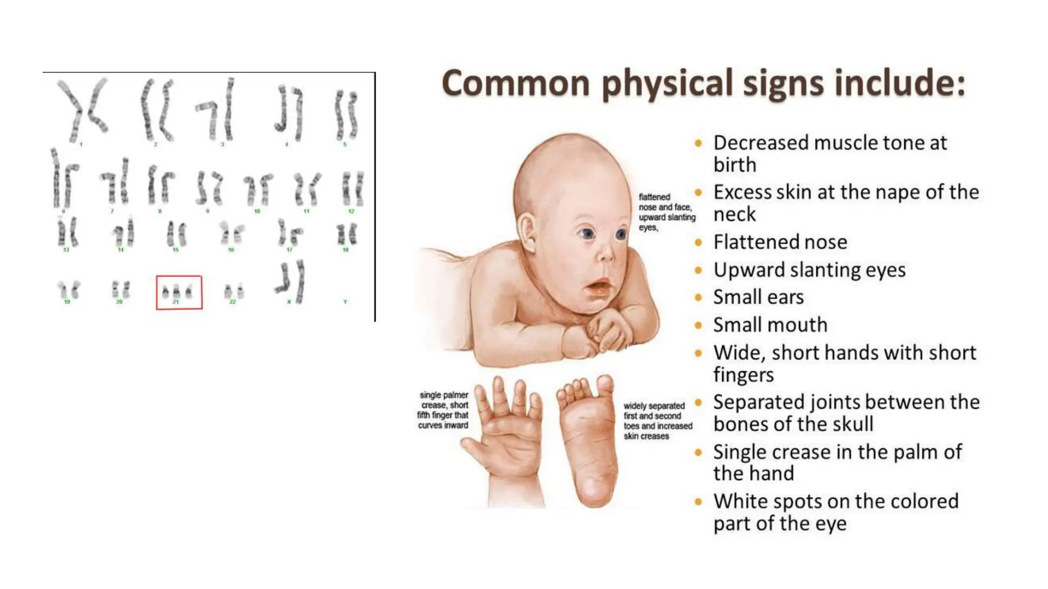 chromosome - Chromosomes + Mutations 3.pptx