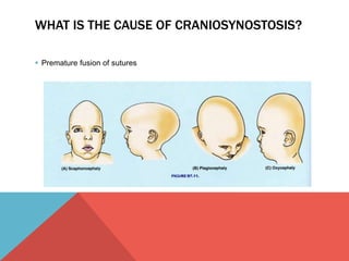 MBB Anatomy | PPTX