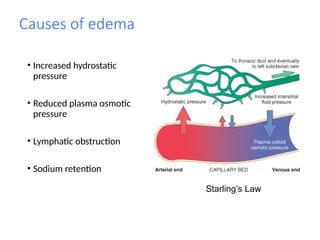 MBBS- Edema.pptx edema and the rest are the only | PPT