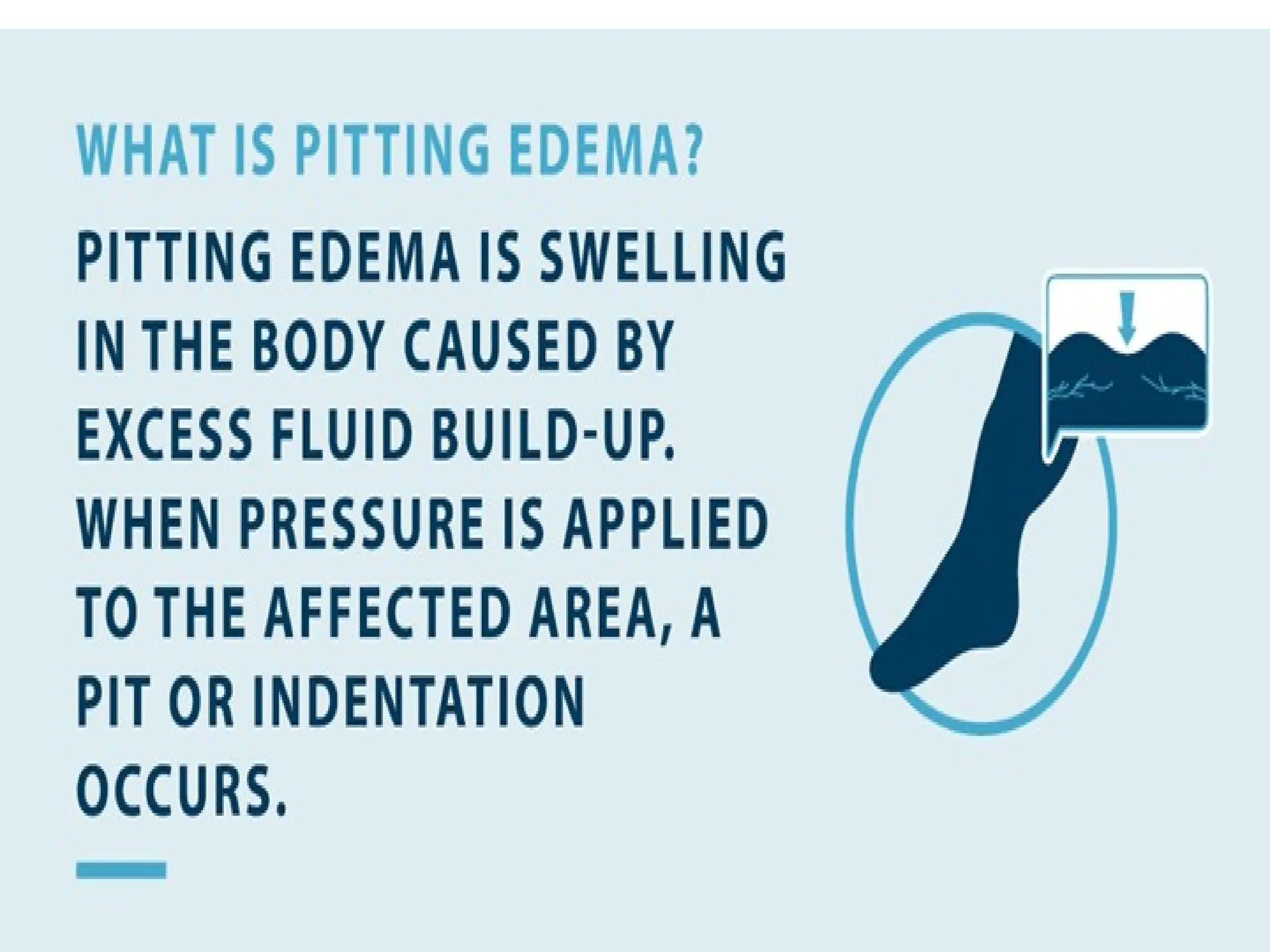 MBBS First year assessment of edema.pptx