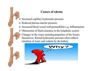 MBBS First year assessment of edema.pptx