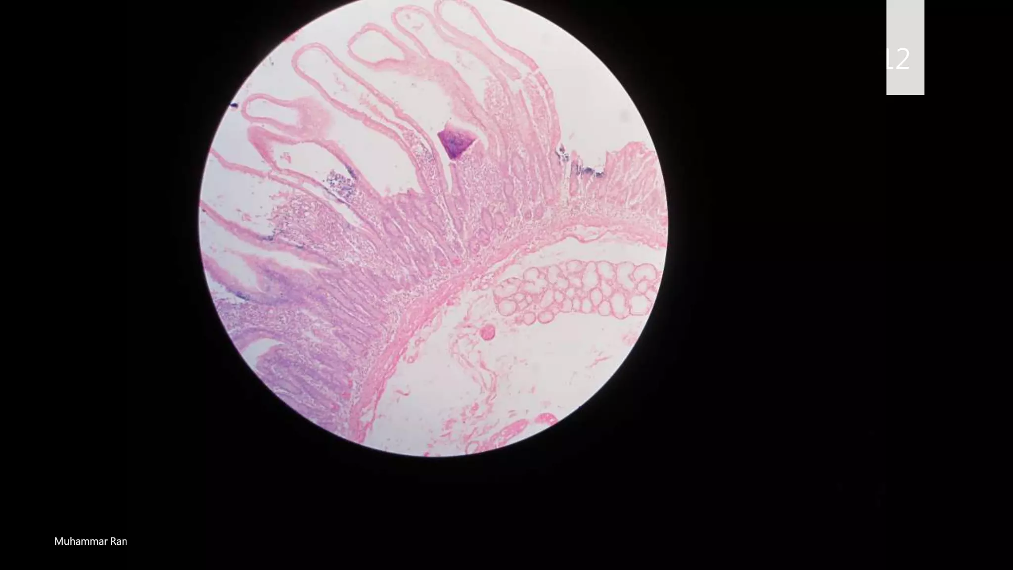 Mbbs part 2 histology slides labelled | PPTX