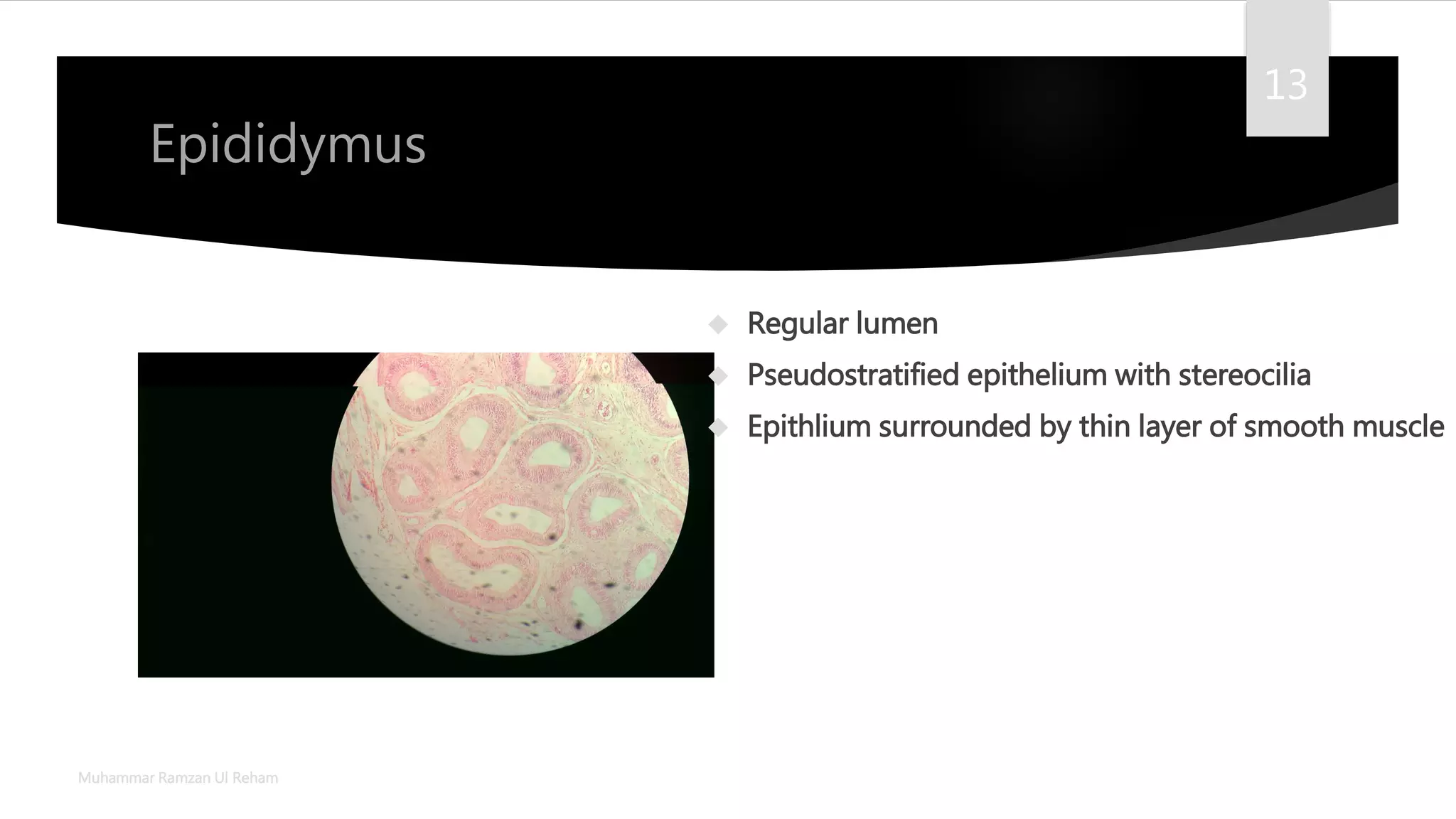 Mbbs part 2 histology slides labelled | PPTX