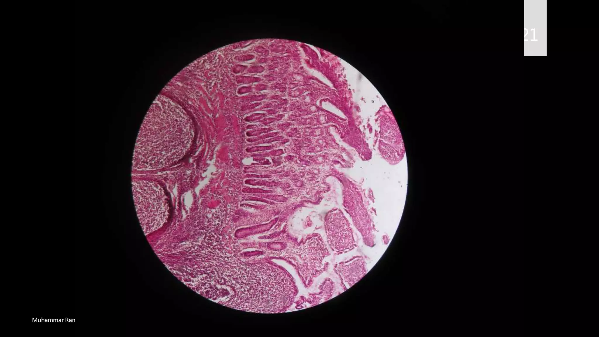 Mbbs part 2 histology slides labelled | PPTX