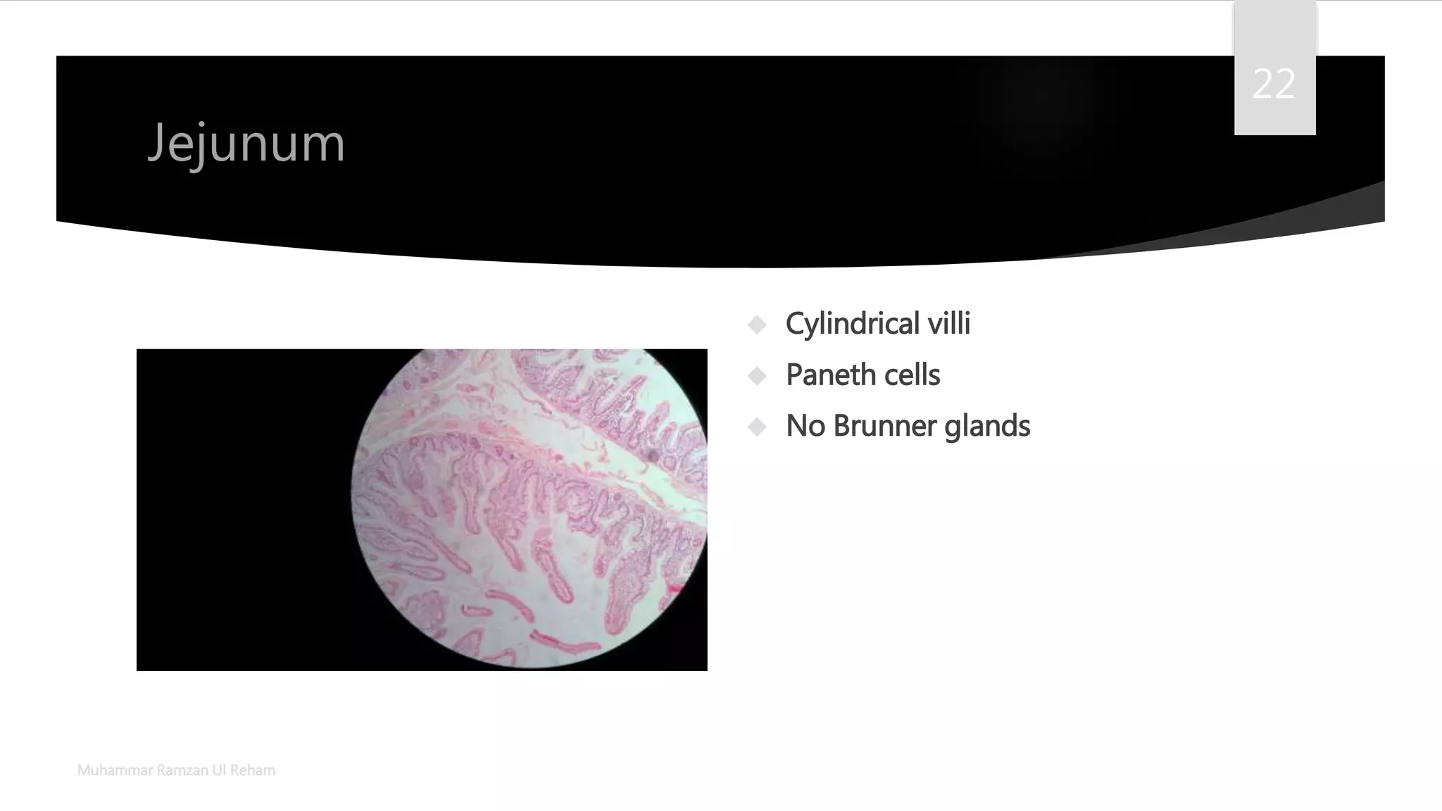Mbbs part 2 histology slides labelled | PPTX