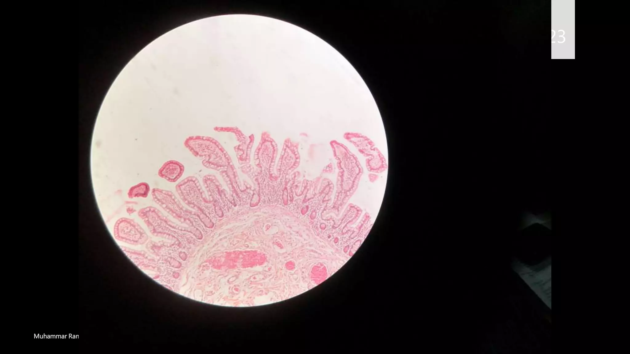 Mbbs part 2 histology slides labelled | PPTX