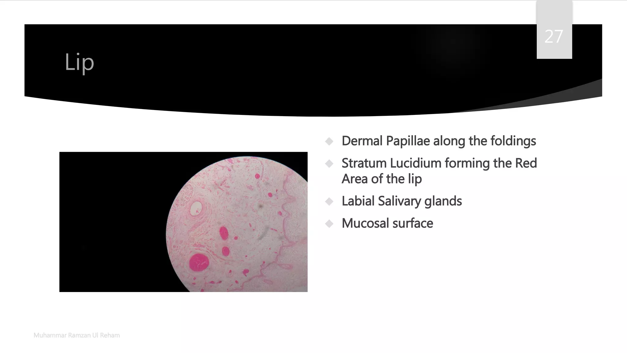 Mbbs part 2 histology slides labelled | PPTX