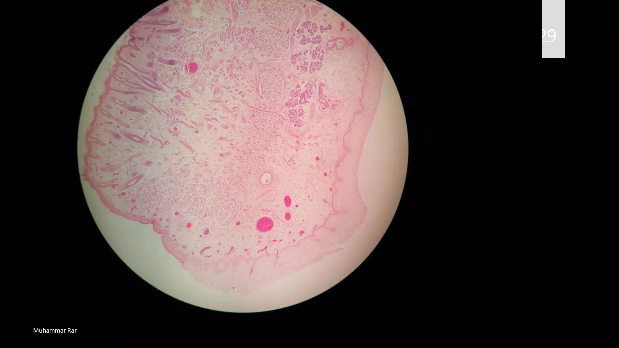 Mbbs part 2 histology slides labelled | PPTX