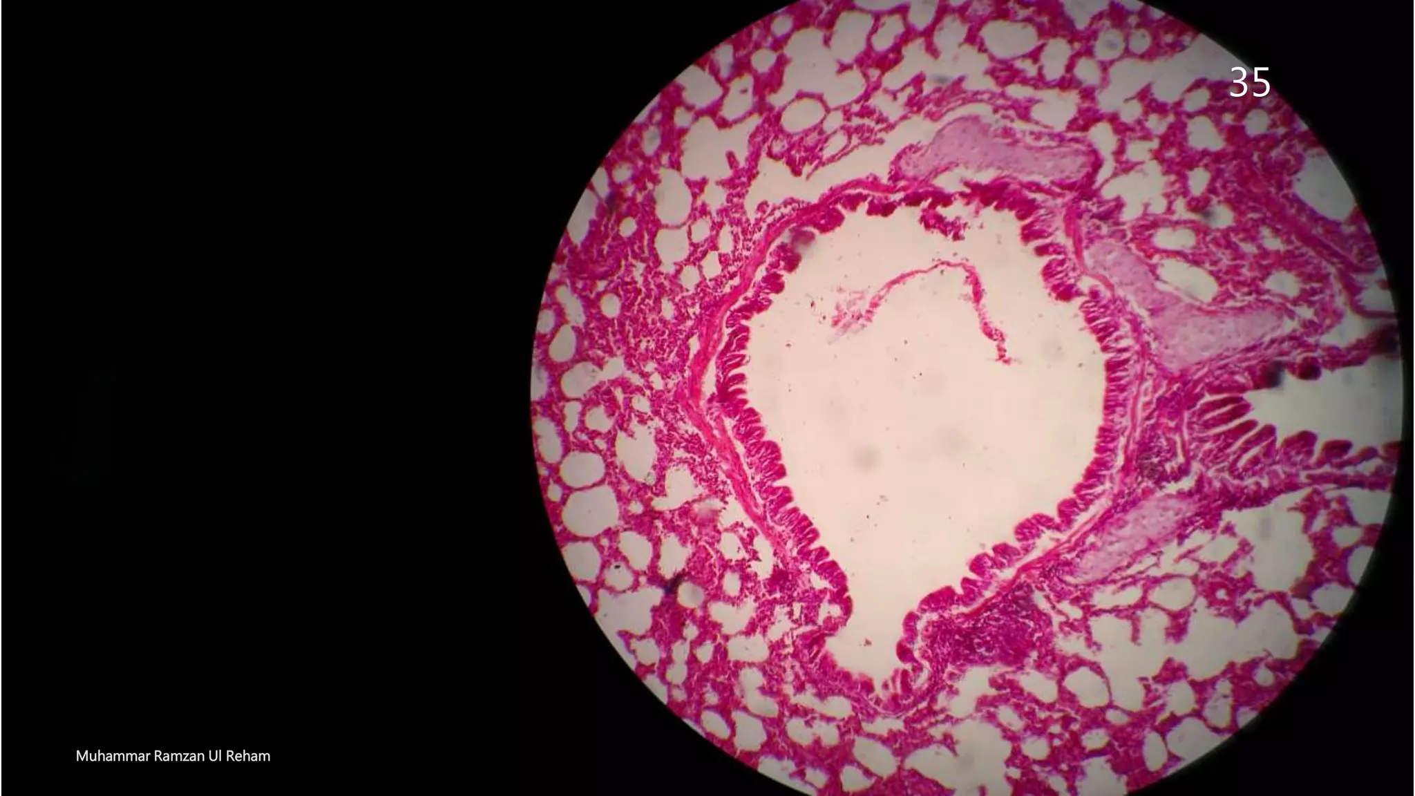 Mbbs part 2 histology slides labelled | PPTX