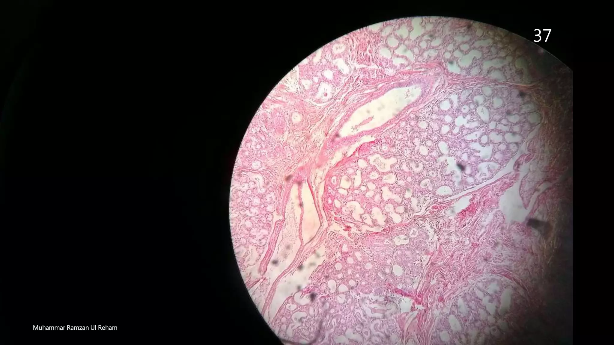 Mbbs part 2 histology slides labelled | PPTX
