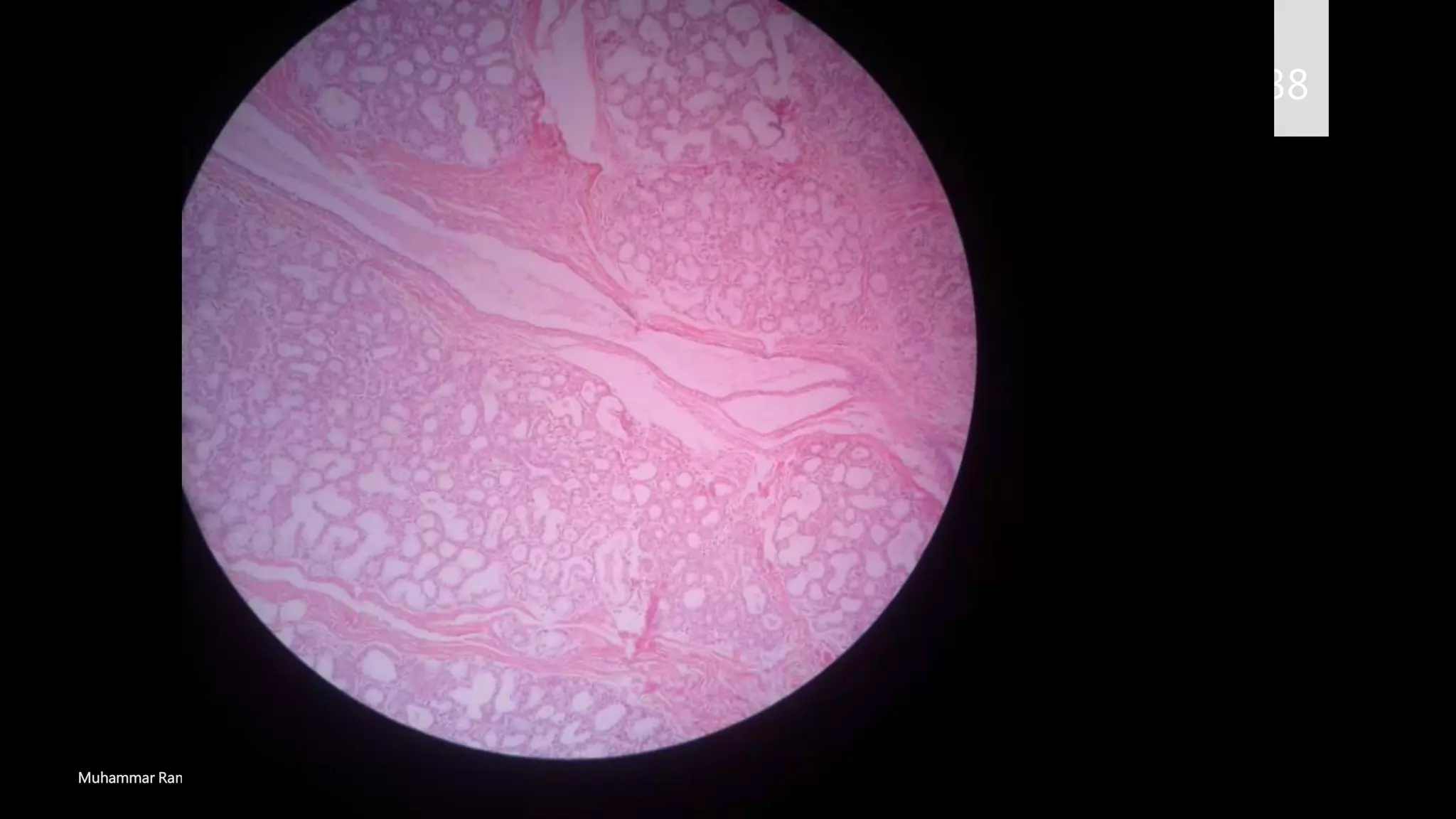 Mbbs part 2 histology slides labelled | PPTX