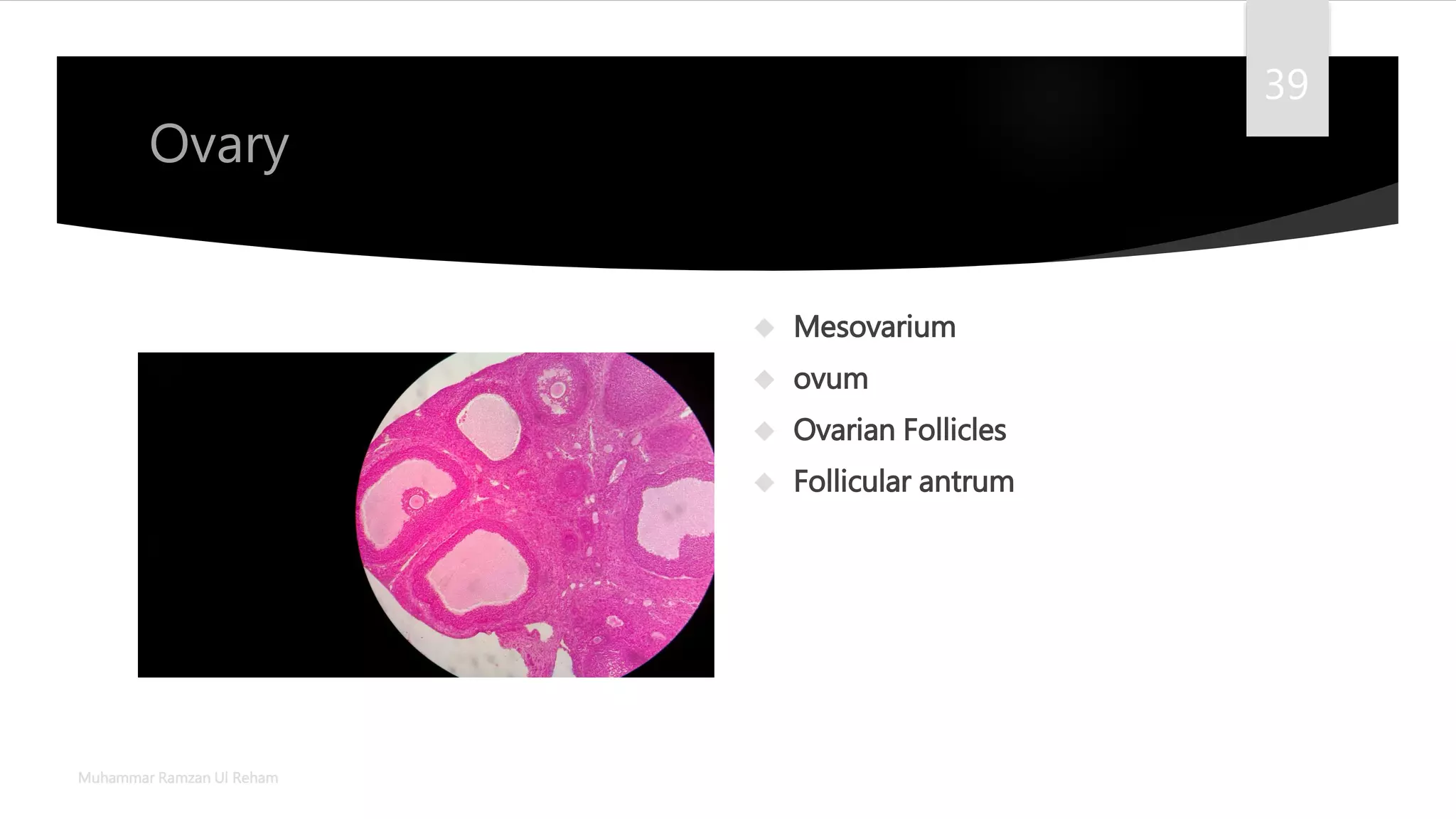 Mbbs part 2 histology slides labelled | PPTX