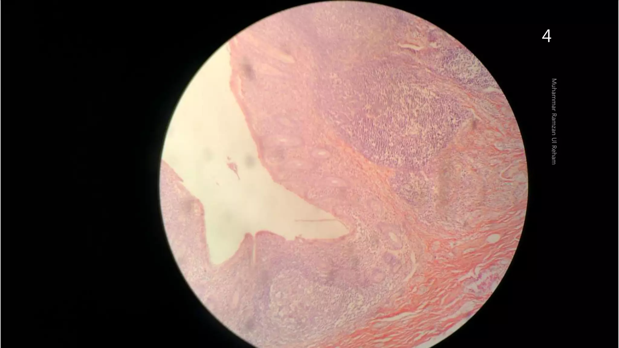 Mbbs part 2 histology slides labelled | PPTX
