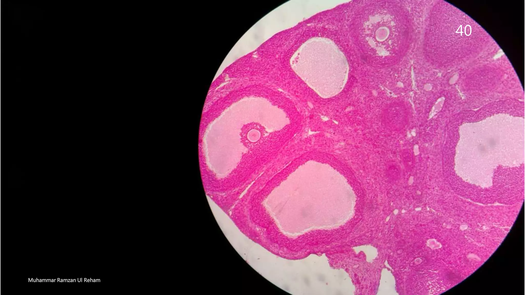 Mbbs part 2 histology slides labelled | PPTX