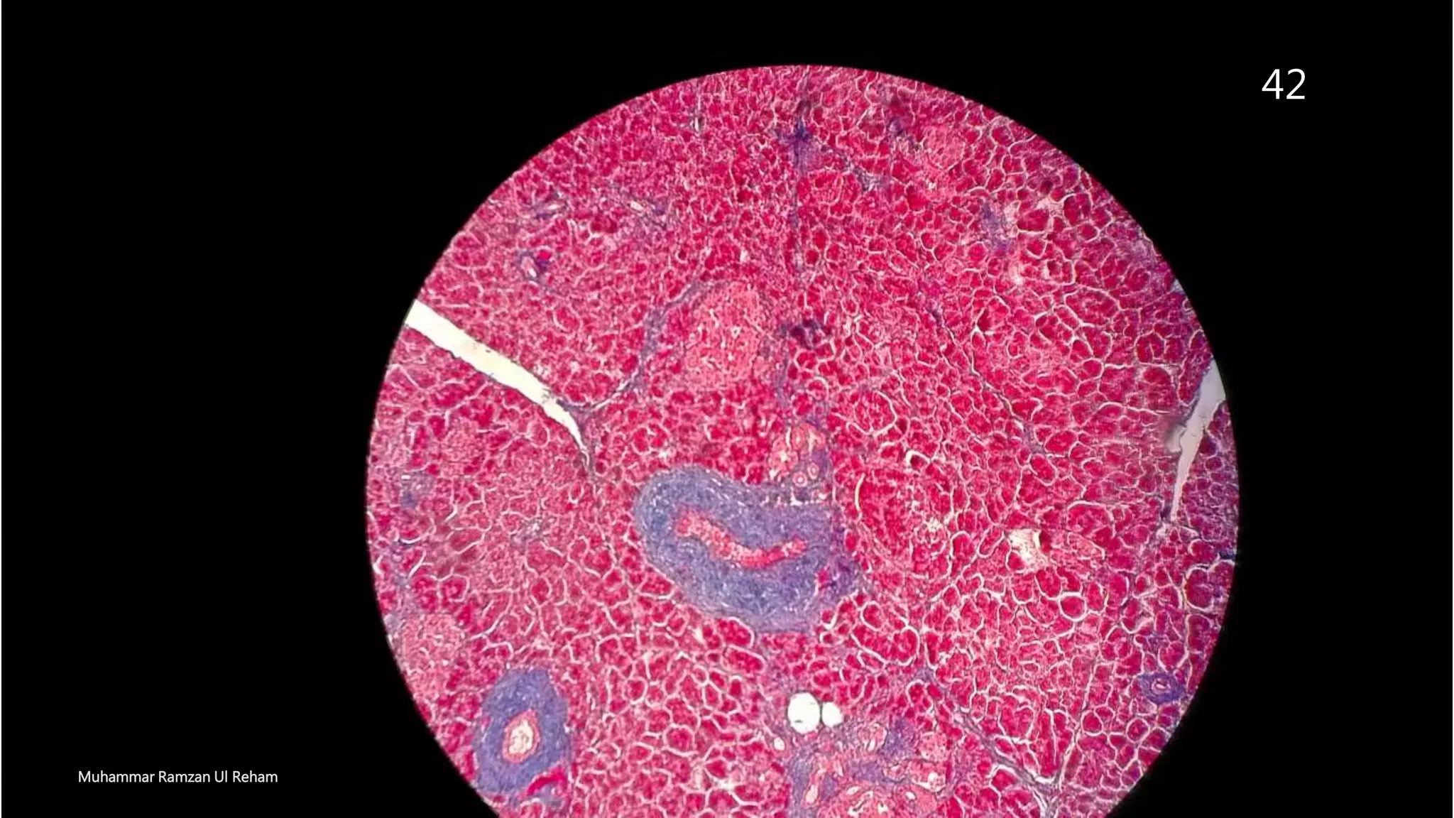 Mbbs part 2 histology slides labelled | PPTX