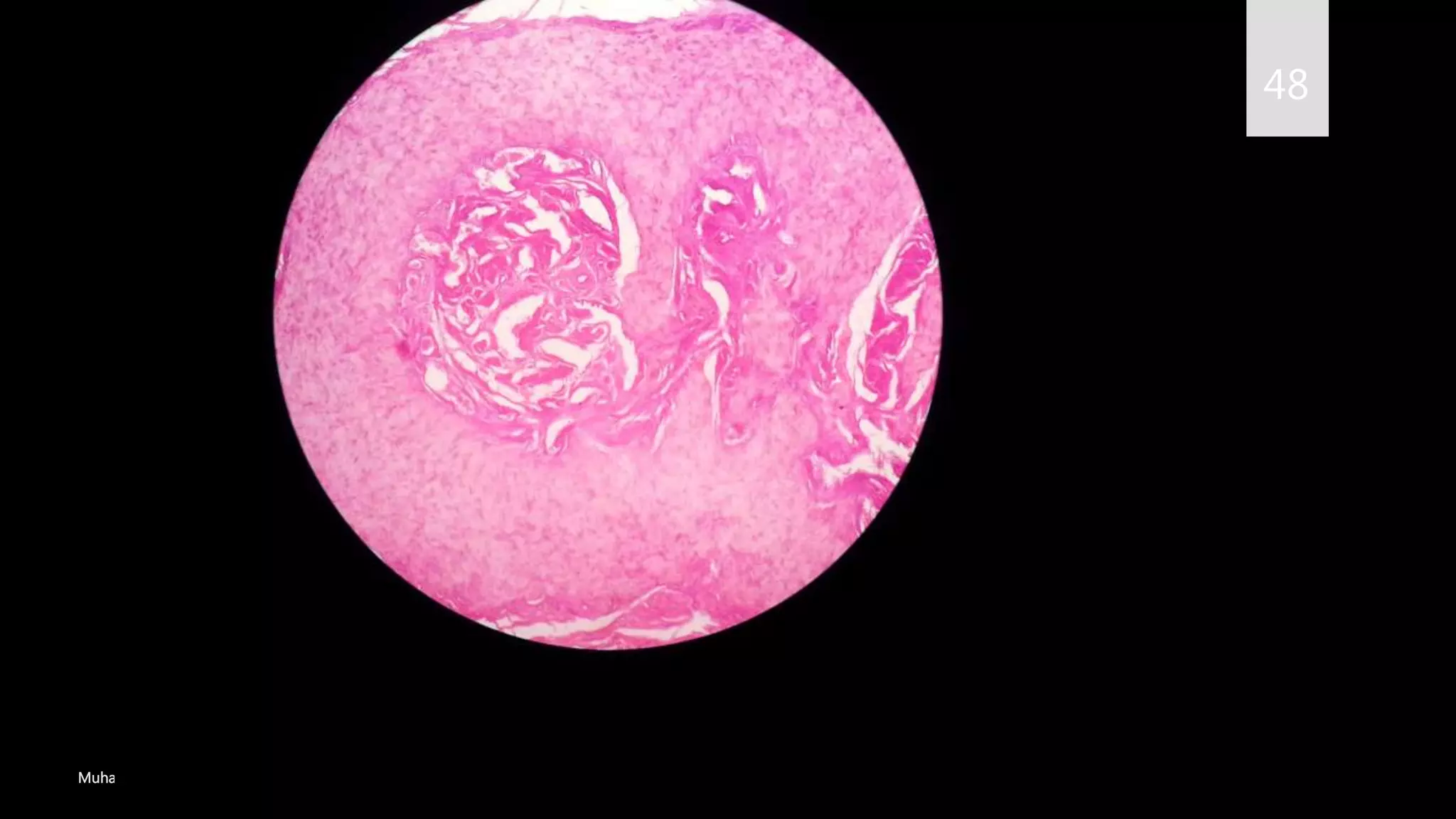 Mbbs part 2 histology slides labelled | PPTX