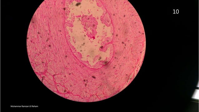 Mbbs part 2 histology slides labelled | PPTX