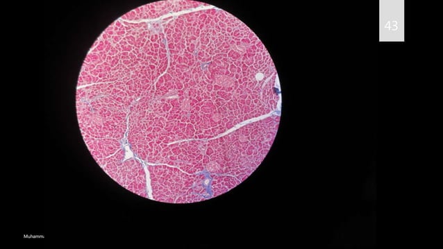 Mbbs part 2 histology slides labelled | PPTX