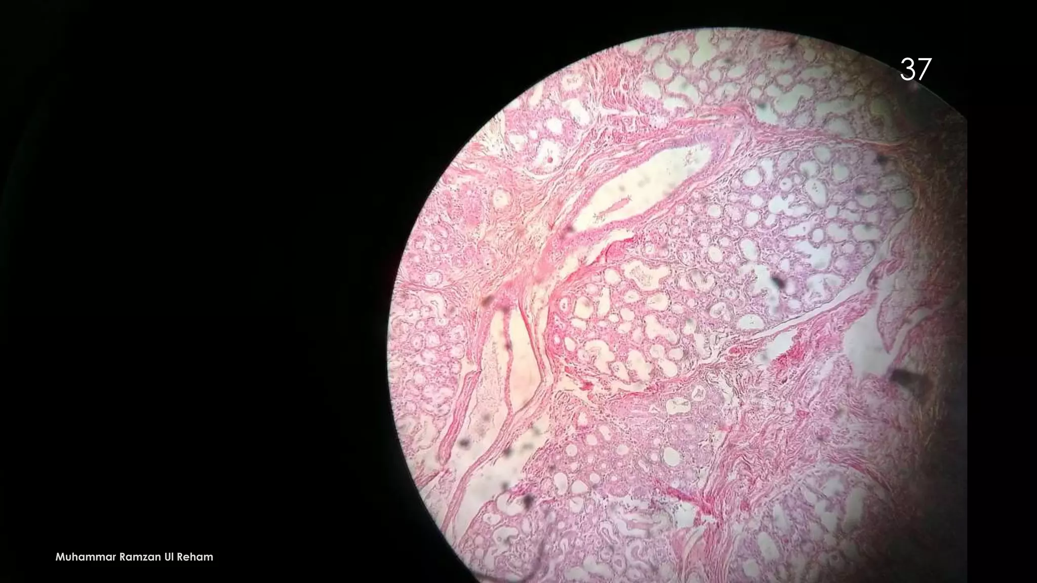 Mbbs part 2 histology slides | PPT