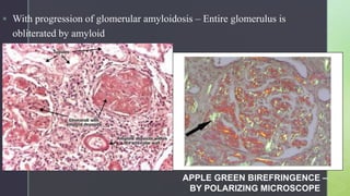 MBBS PPT - AMYLOIDOSIS types diagnostic approach and staining ...