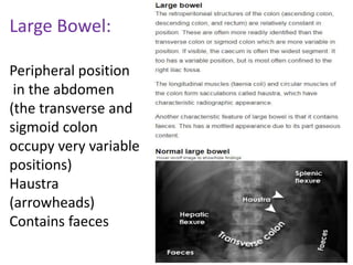 Medicine approach to plain abdominal XRAYS.pptx