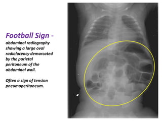 Medicine approach to plain abdominal XRAYS.pptx