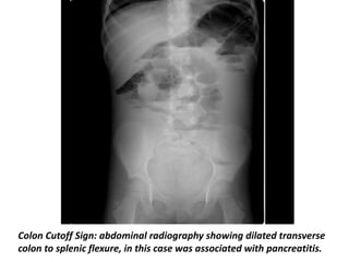 Medicine approach to plain abdominal XRAYS.pptx