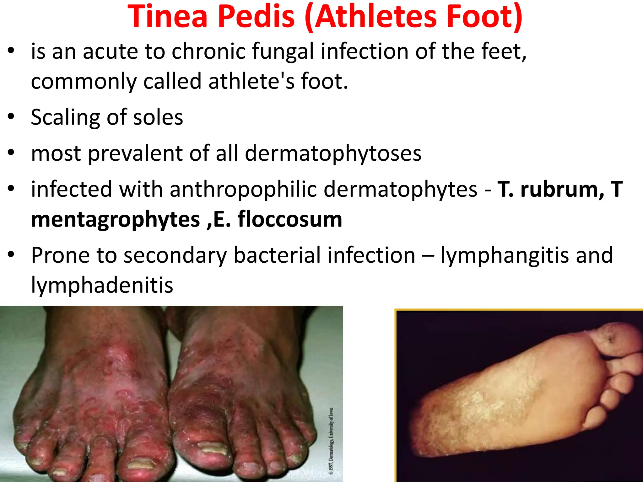 Introduction to superficial mycoses Apr2024.ppt