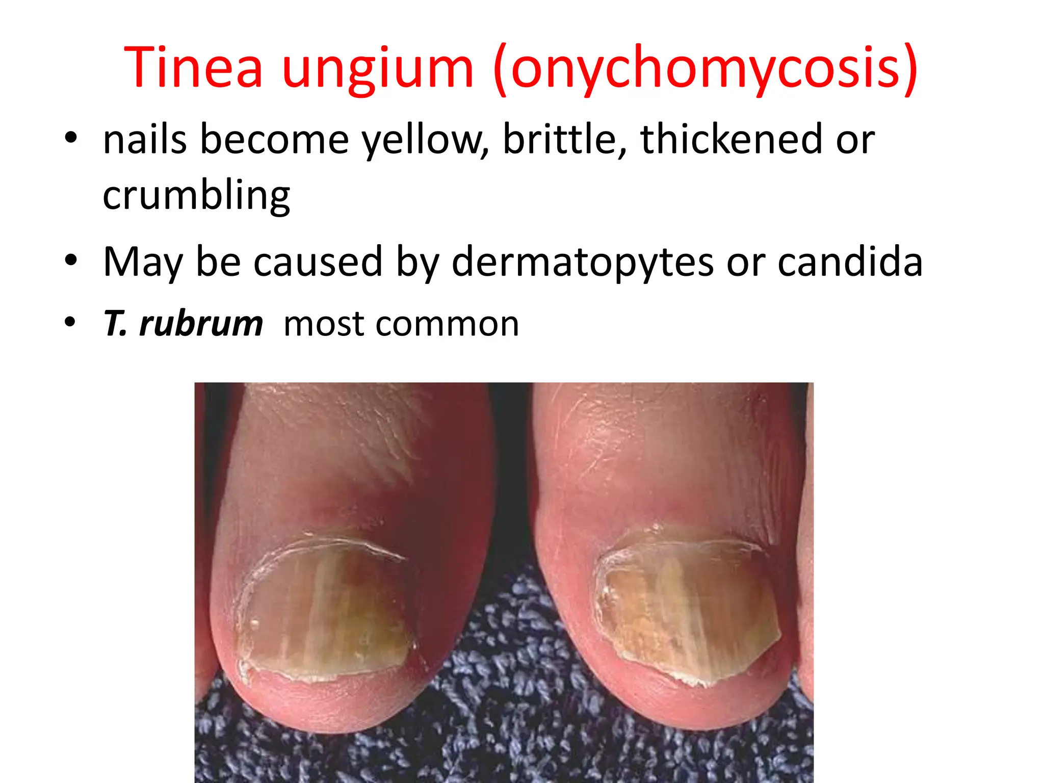 Introduction to superficial mycoses Apr2024.ppt