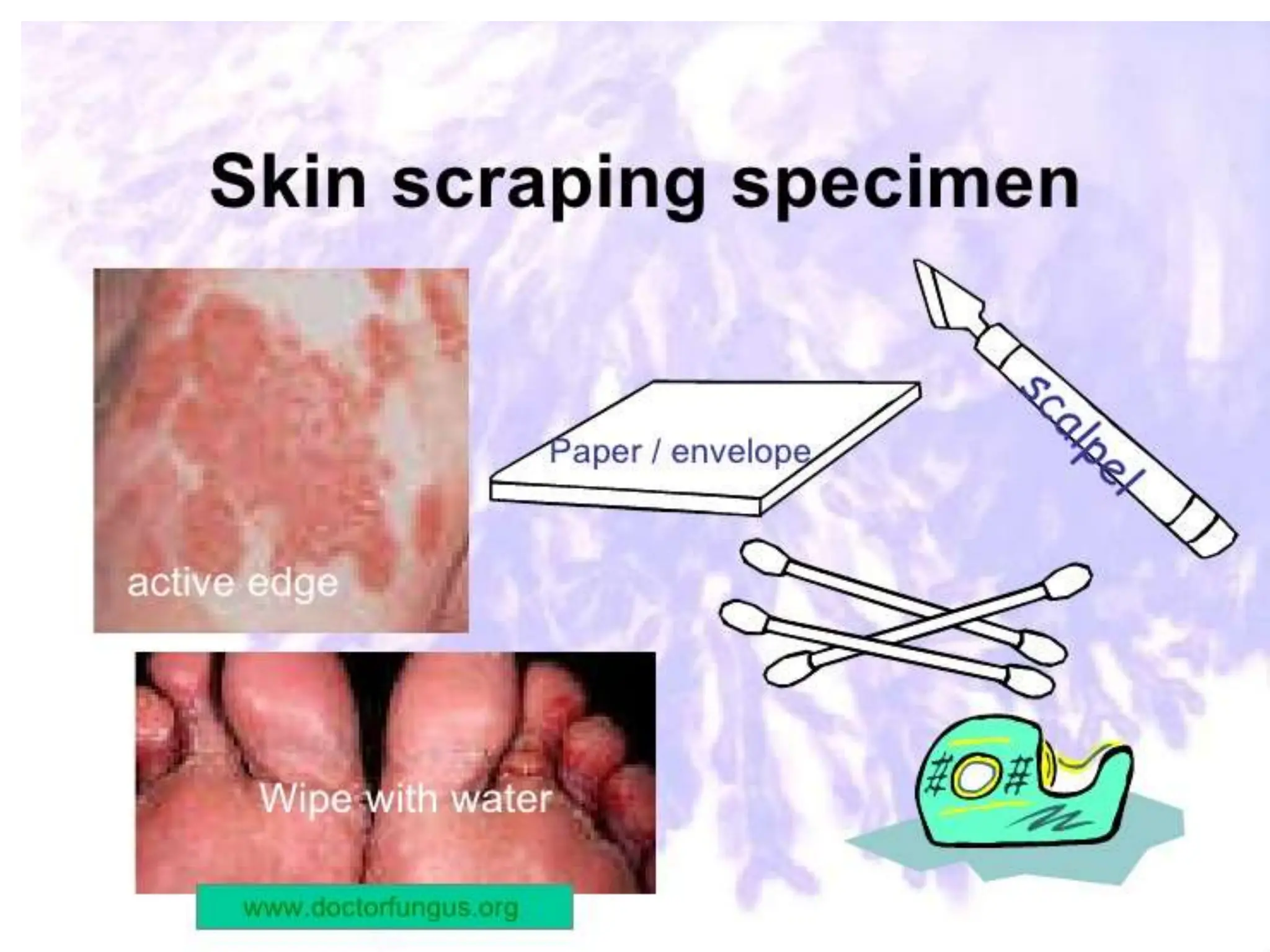 Introduction to superficial mycoses Apr2024.ppt