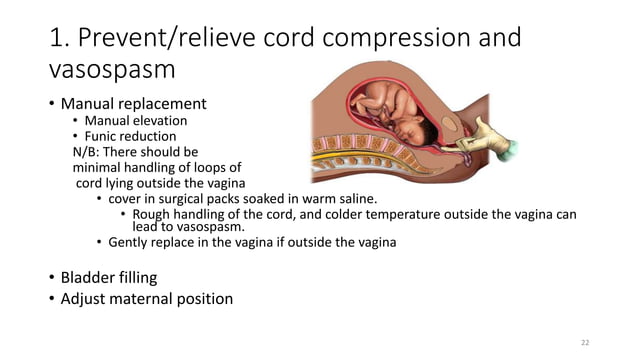 Cord Prolapse | PPT