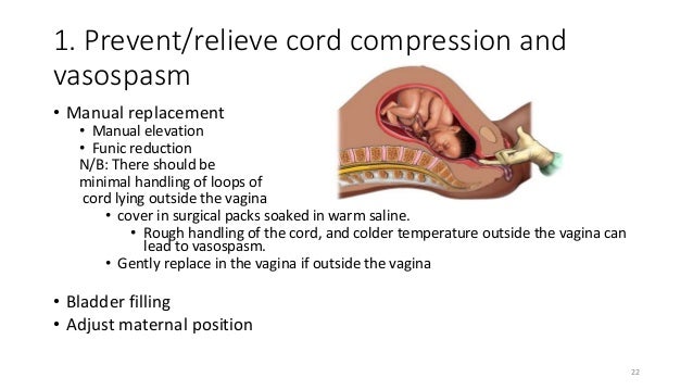Cord Prolapse