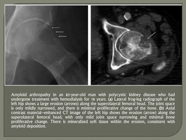 Imaging In Metabolic Bone Diseases | PPTX | Bone and Joint Conditions | Diseases and Conditions