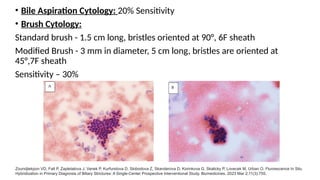 Role of Endoscopy in Malignant Biliary Obstruction.pptx