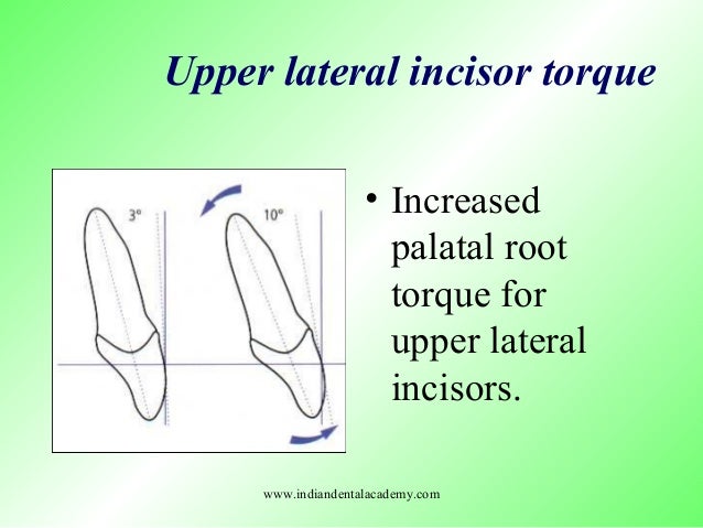 MBT Technique /certified fixed orthodontic courses by Indian dental a…