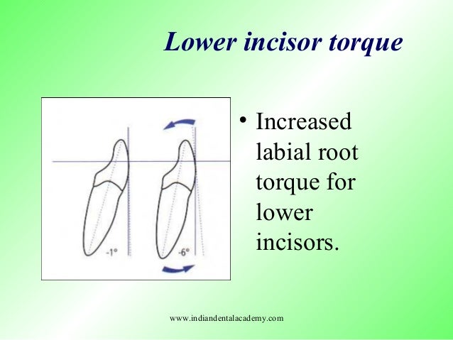 MBT Technique /certified fixed orthodontic courses by Indian dental a…
