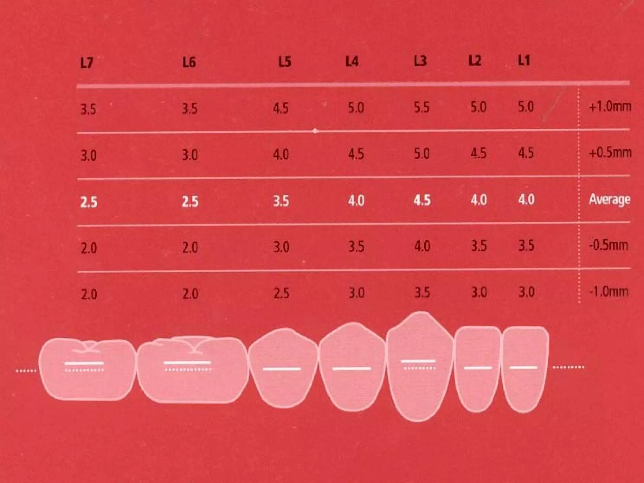 MBT system in orthodontics /certified fixed orthodontic courses by ...