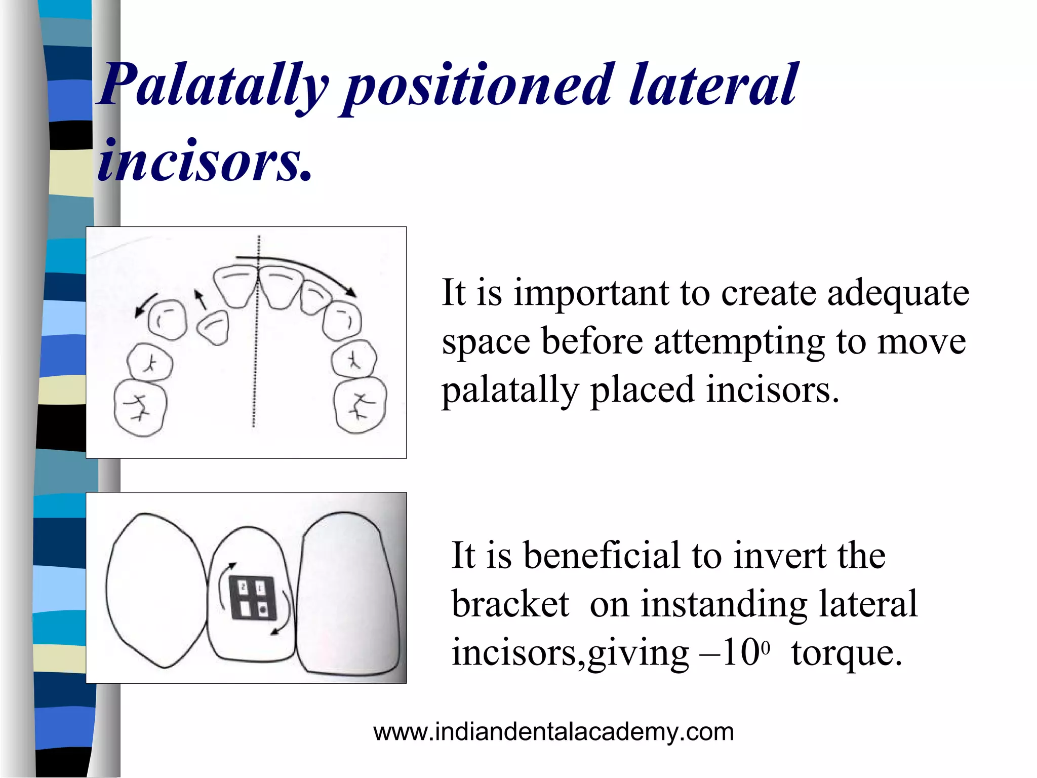 MBT system in orthodontics /certified fixed orthodontic courses by ...