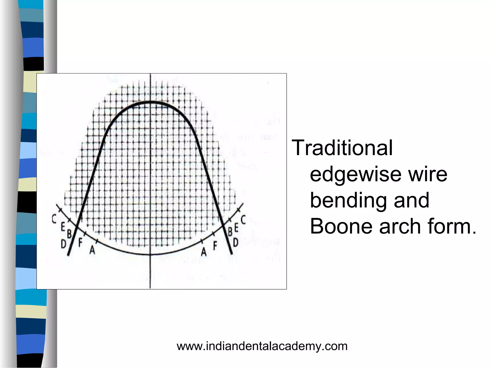 MBT system in orthodontics /certified fixed orthodontic courses by ...